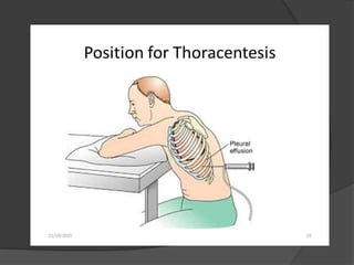 Thoracentesis Position