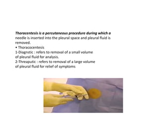 thoracentesis.pptx