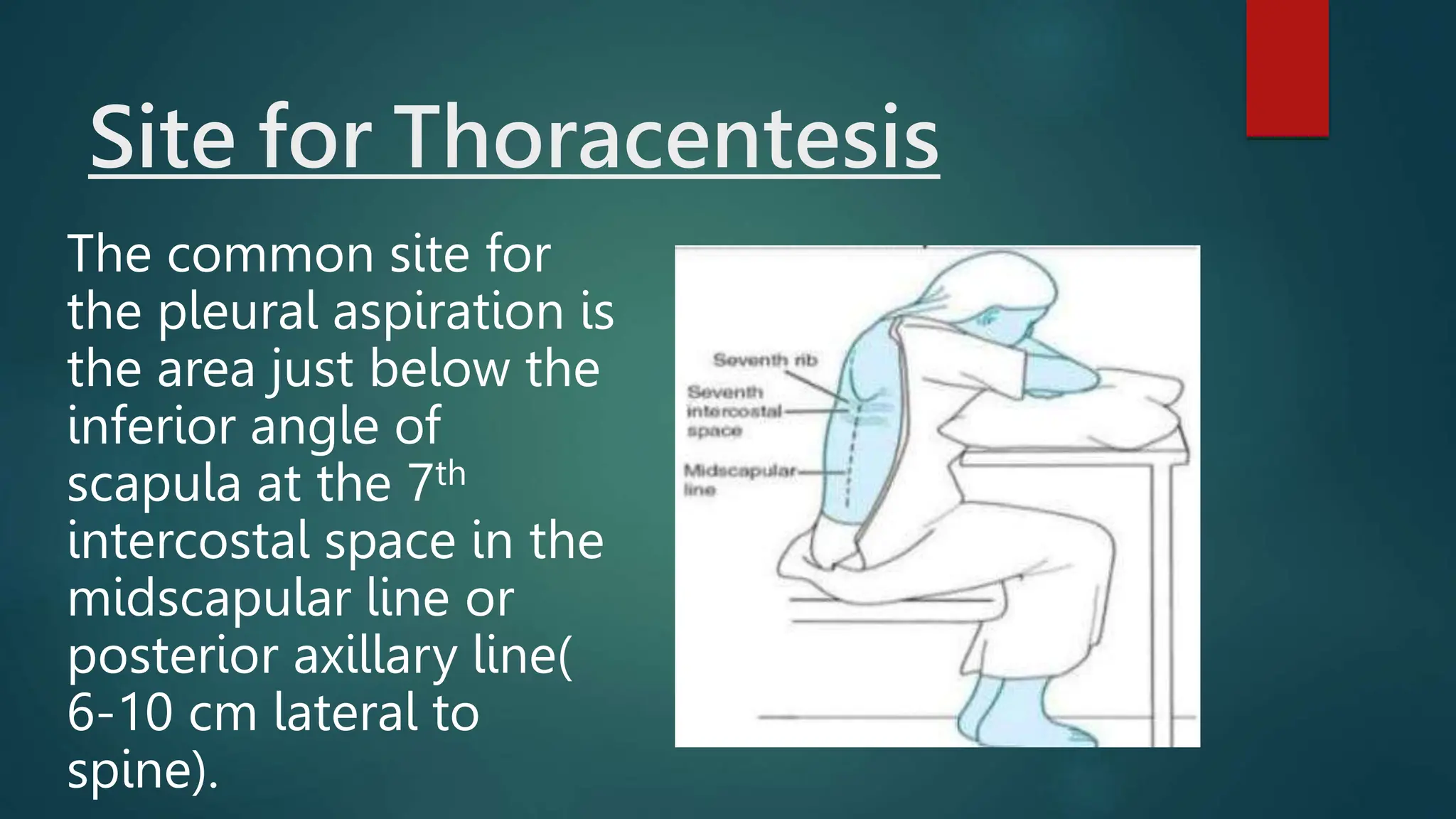 Procedure Practical - thoracentesis.pptx