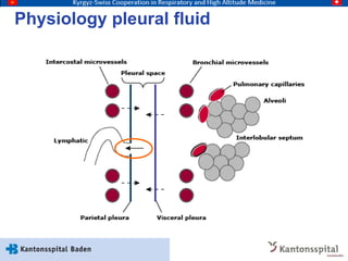 Thoracentesis - pleural effusion for students | PPTX