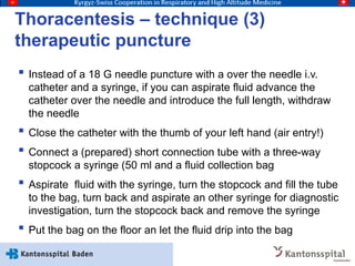 Thoracentesis - pleural effusion for students | PPTX