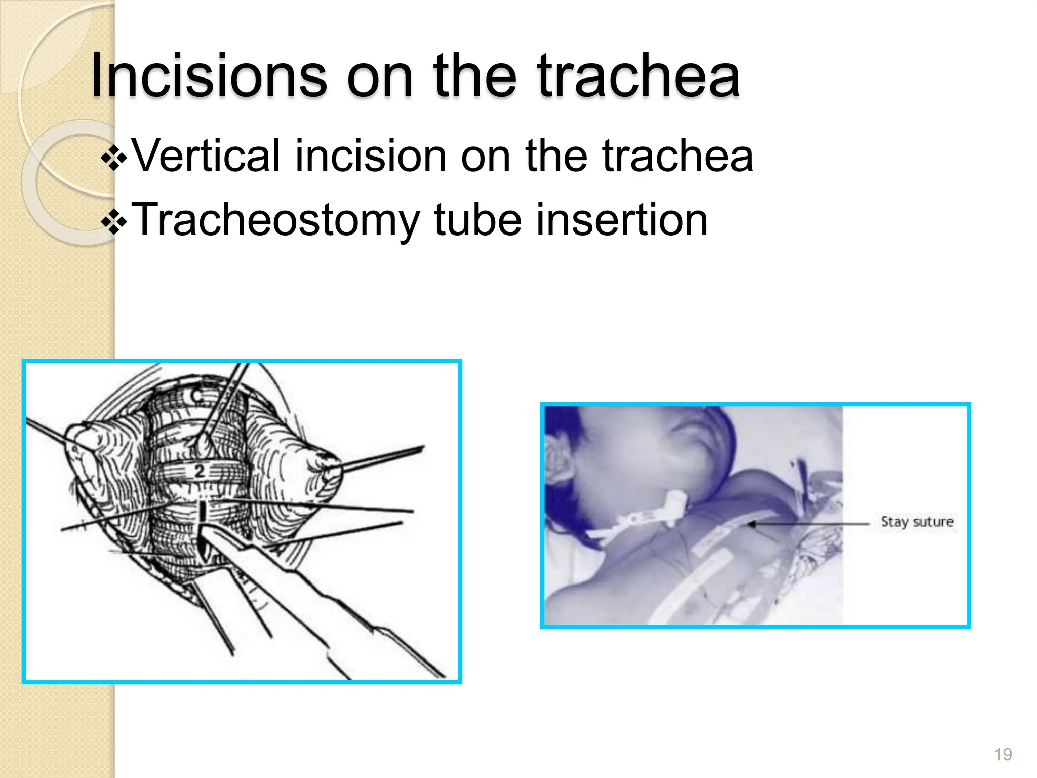 Thoracentesis and Chest tube insertion.pptx