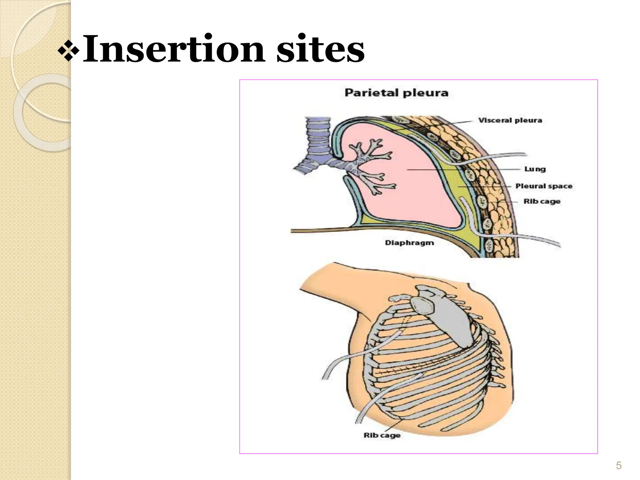 Thoracentesis and Chest tube insertion.pptx