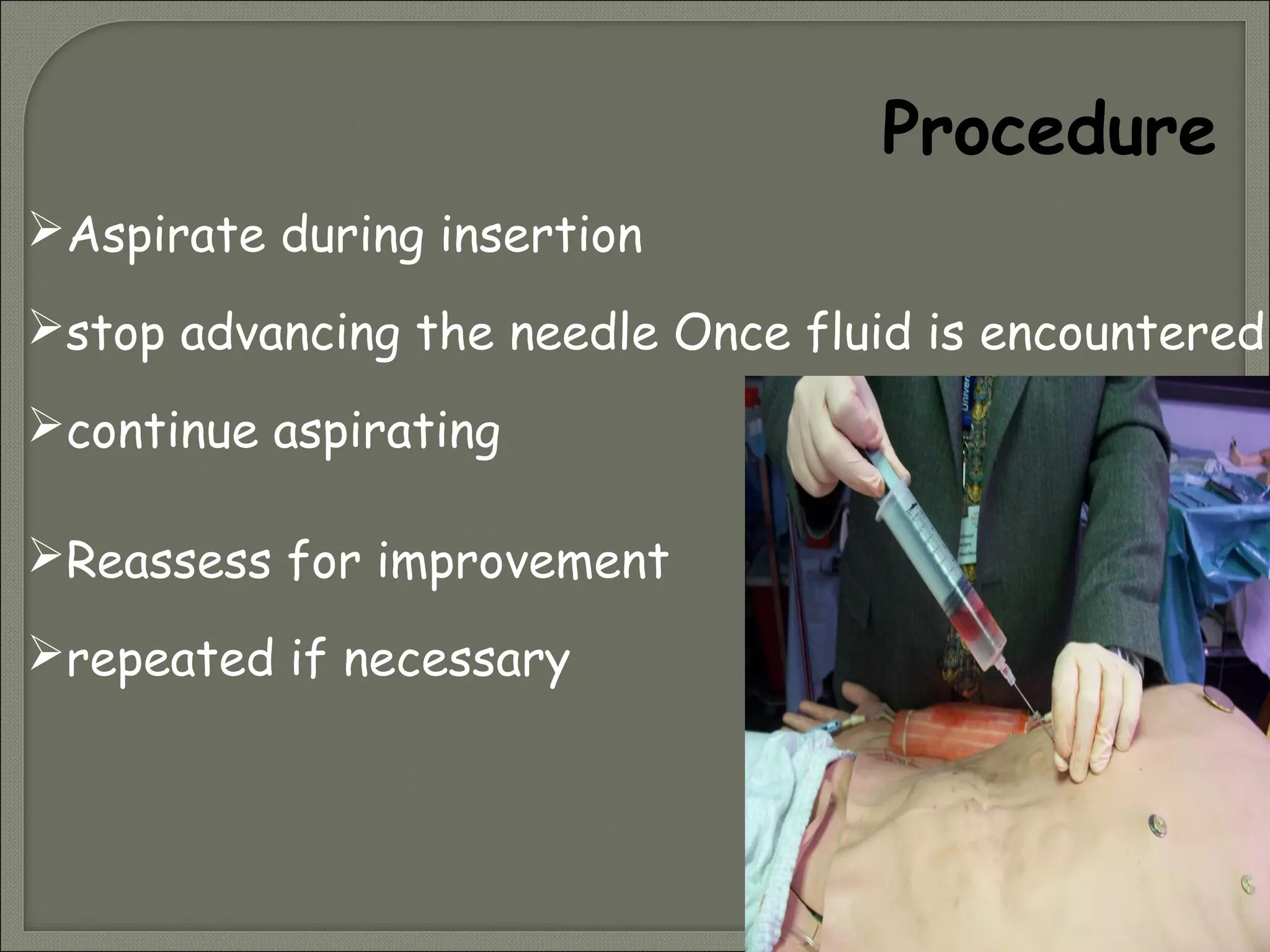 Thoracentesis | PPT