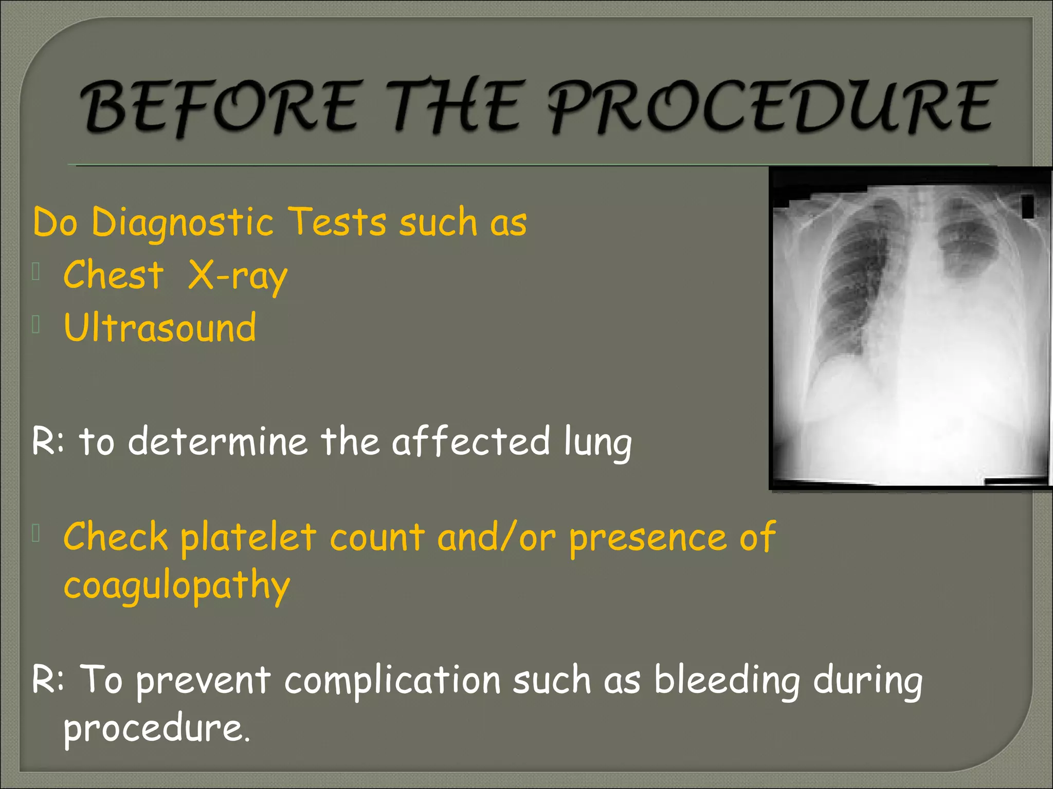 Thoracentesis | PPT