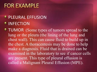 Thoracentesis | PPTX