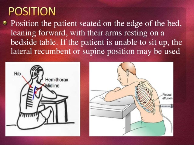 Thoracentesis Procedure