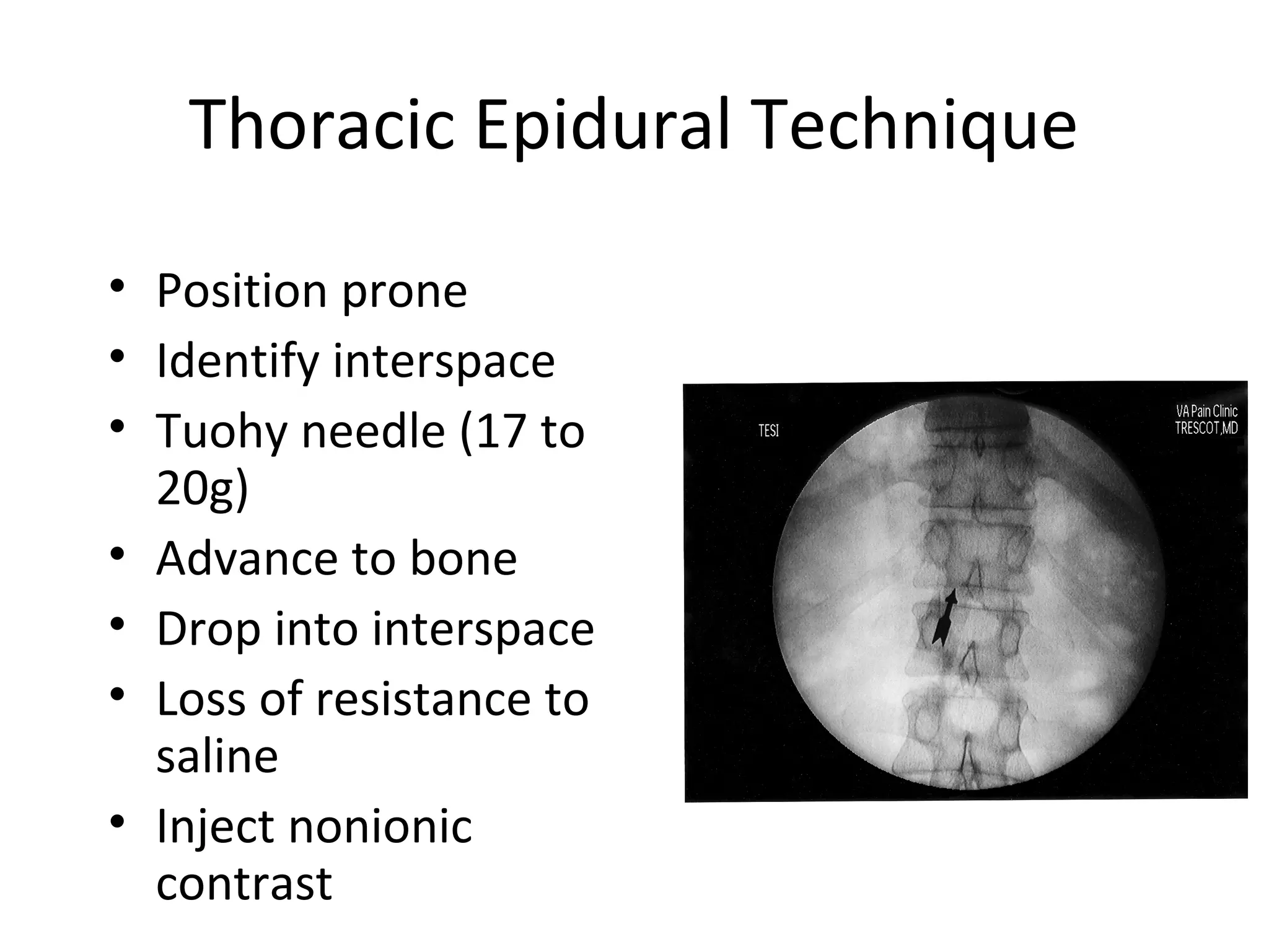thoracic interventions.ppt