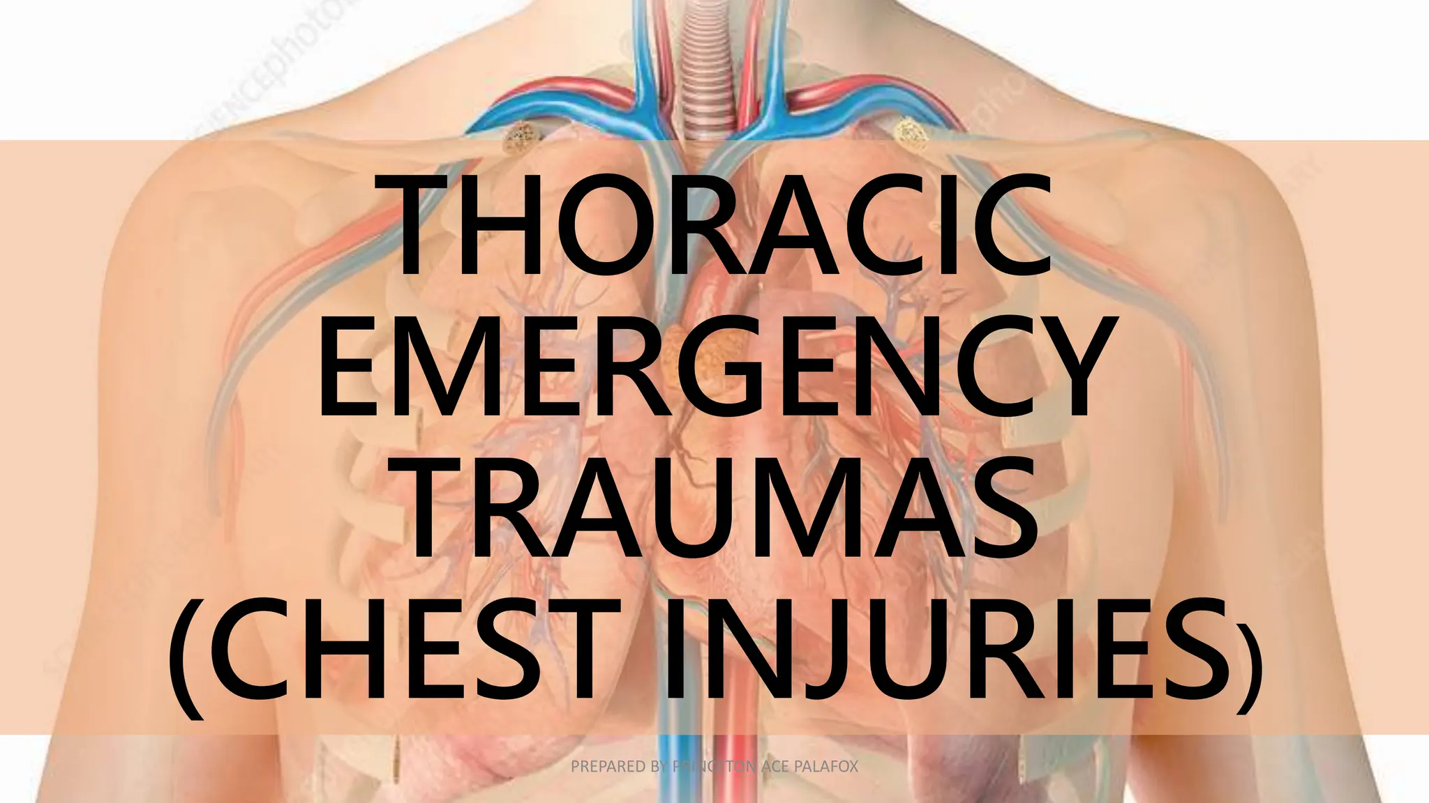 THORACIC-EMERGENCY-TRAUMAS to help us what to do | PPT