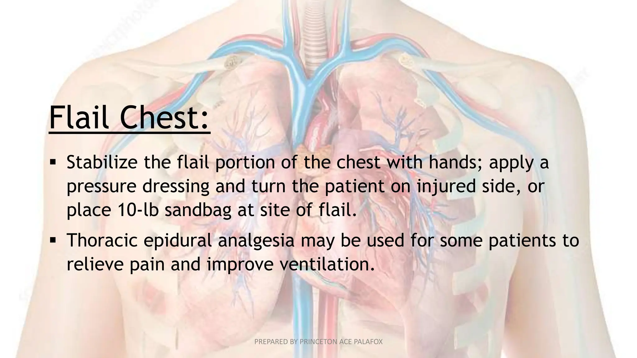 THORACIC-EMERGENCY-TRAUMAS to help us what to do | PPTX