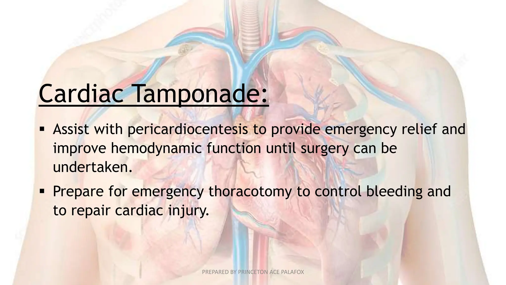 THORACIC-EMERGENCY-TRAUMAS to help us what to do | PPTX
