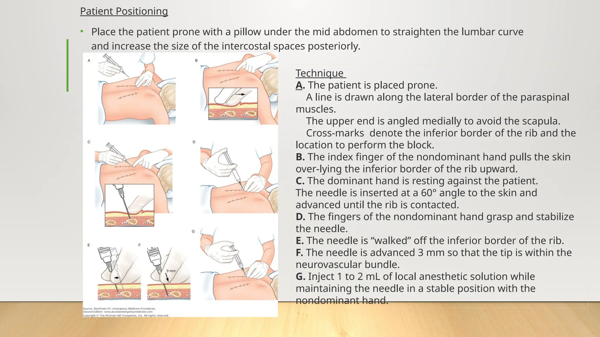 ANESTHESIA Thoracic & abdominal wall blocks.pptx