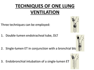 Thoracic anaesthesia One lung ventilation | PPTX