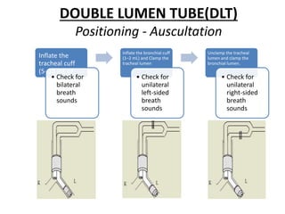 Thoracic anaesthesia One lung ventilation | PPTX