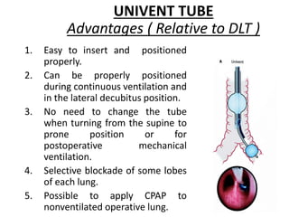 Thoracic anaesthesia One lung ventilation | PPTX