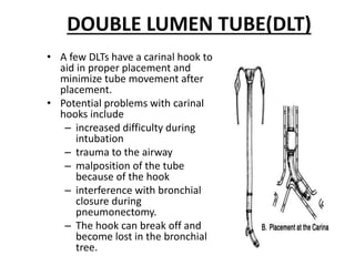 Thoracic anaesthesia One lung ventilation