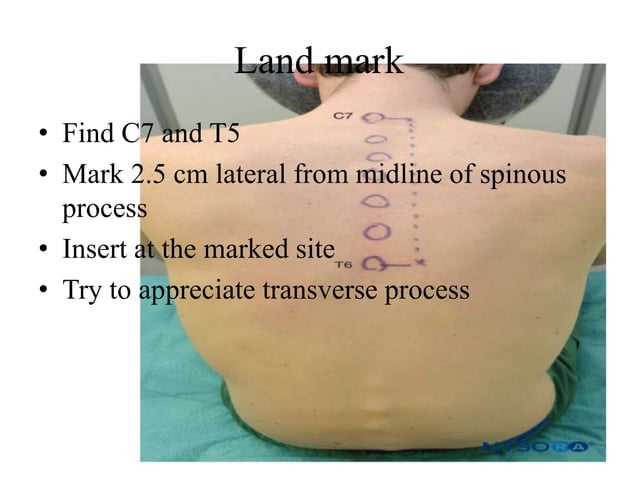 Thoracic and abdominal field blocks.pptx