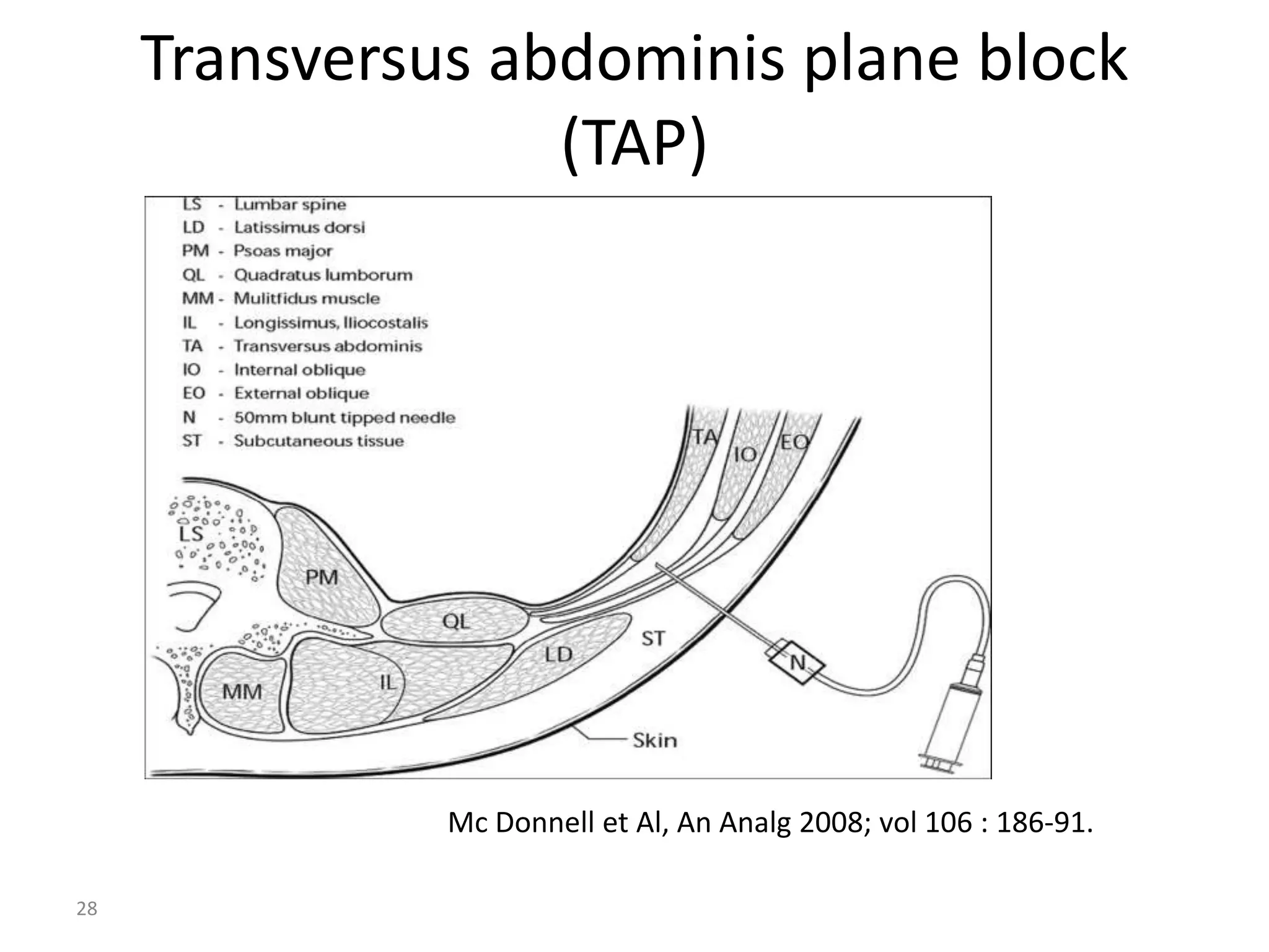 Thoracic and abdominal nerve blocks | PPTX