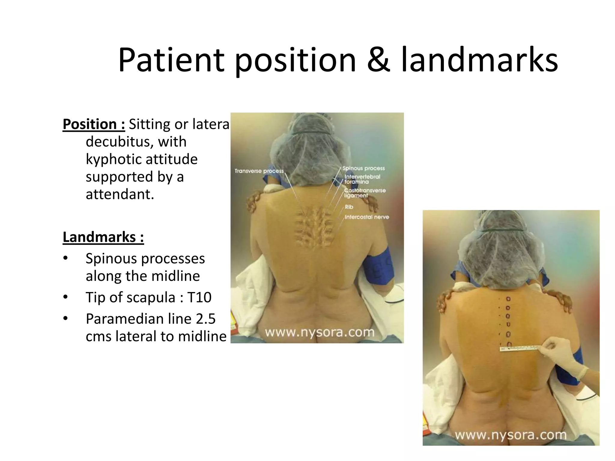 Thoracic and abdominal nerve blocks | PPTX