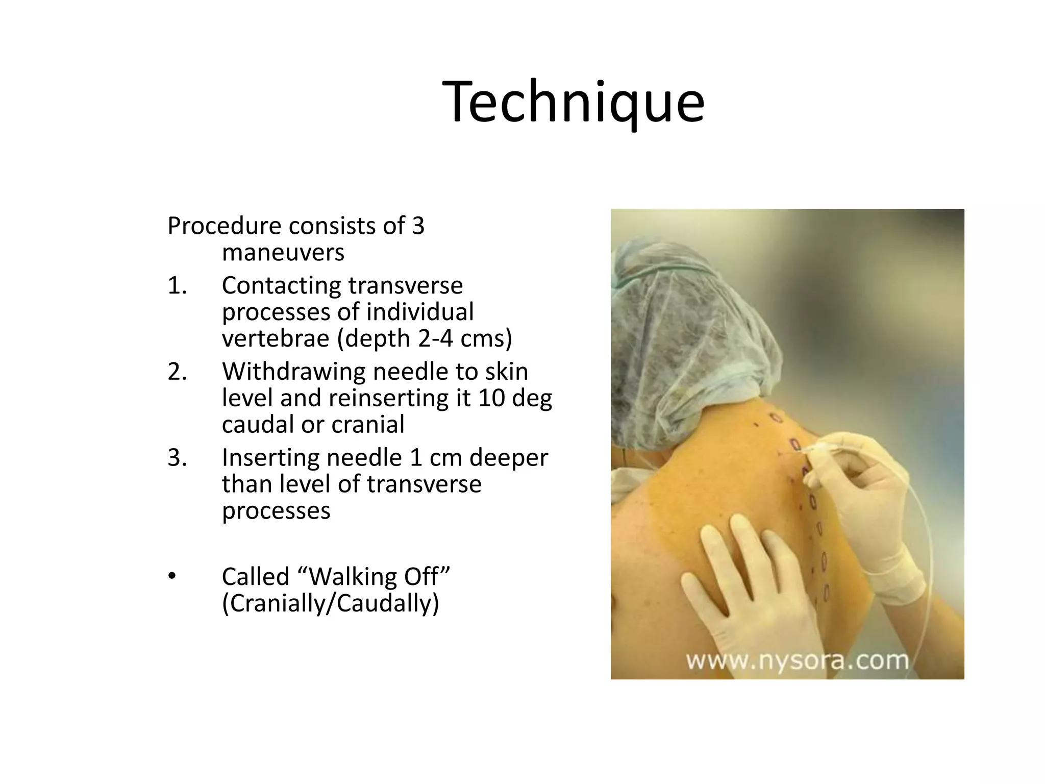 Thoracic and abdominal nerve blocks | PPTX