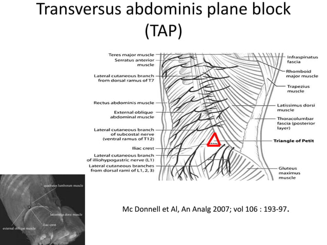 Thoracic and abdominal nerve blocks | PPTX