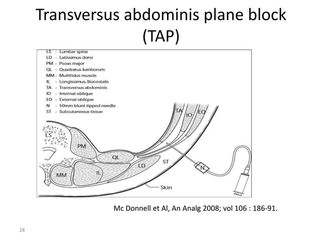 Thoracic and abdominal nerve blocks | PPTX