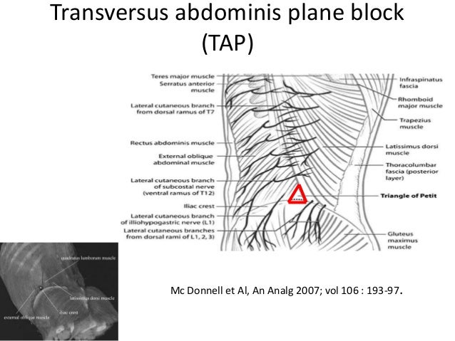 Thoracic and abdominal nerve blocks