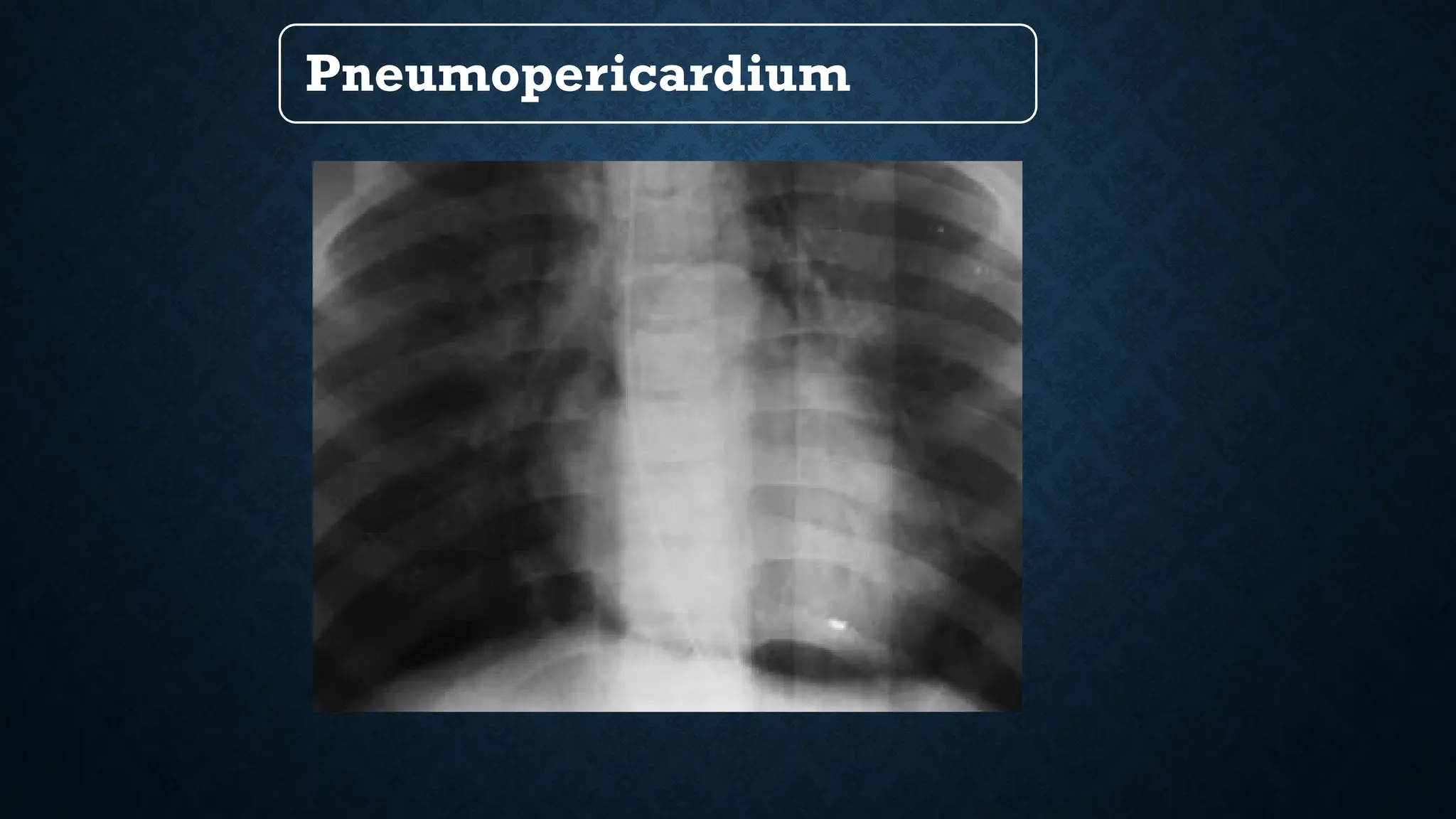 thoracic and abdominal trauma radiology finding | PPTX