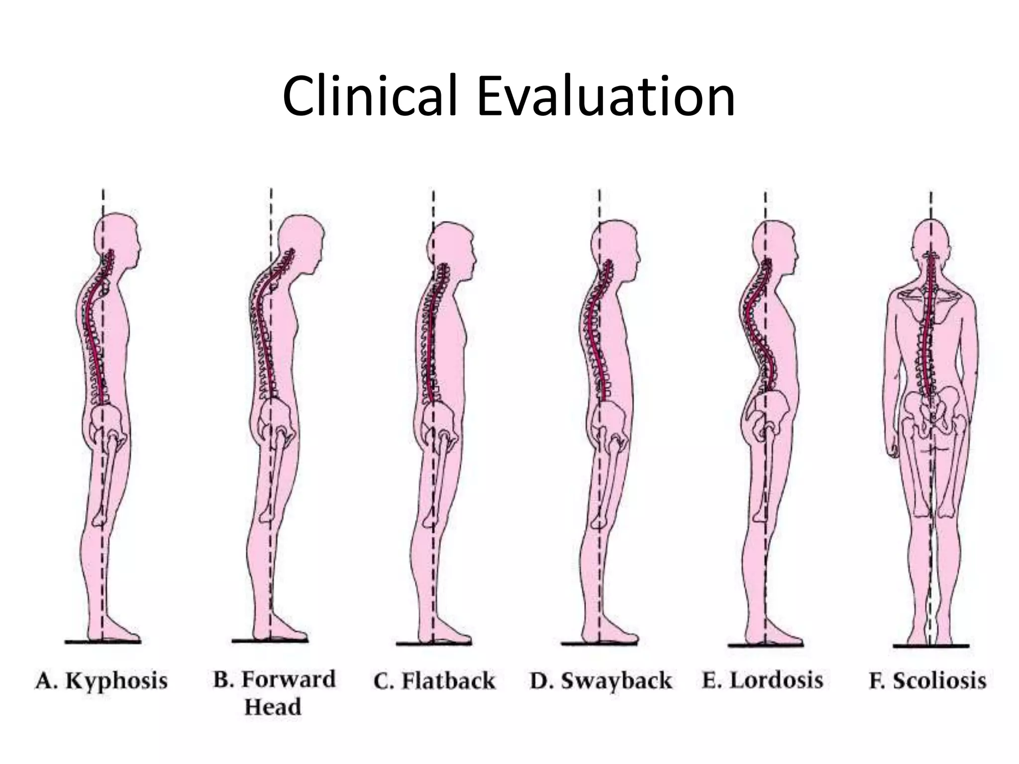 thoracic and lumbar spine-1.pptx