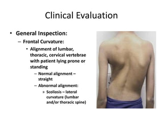 thoracic and lumbar spine-1.pptx | Free Download