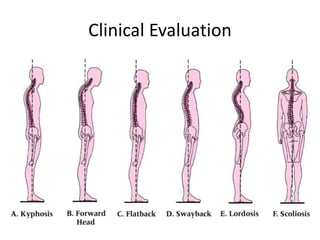 thoracic and lumbar spine-1.pptx