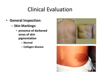 thoracic and lumbar spine-1.pptx