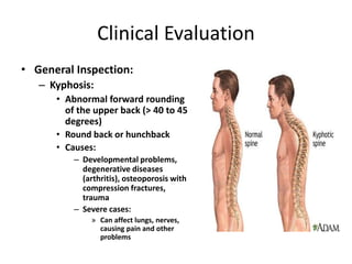 thoracic and lumbar spine-1.pptx
