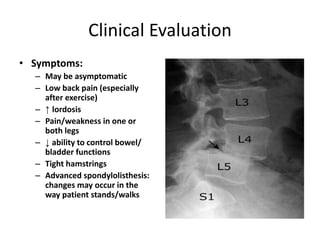 thoracic and lumbar spine-1.pptx