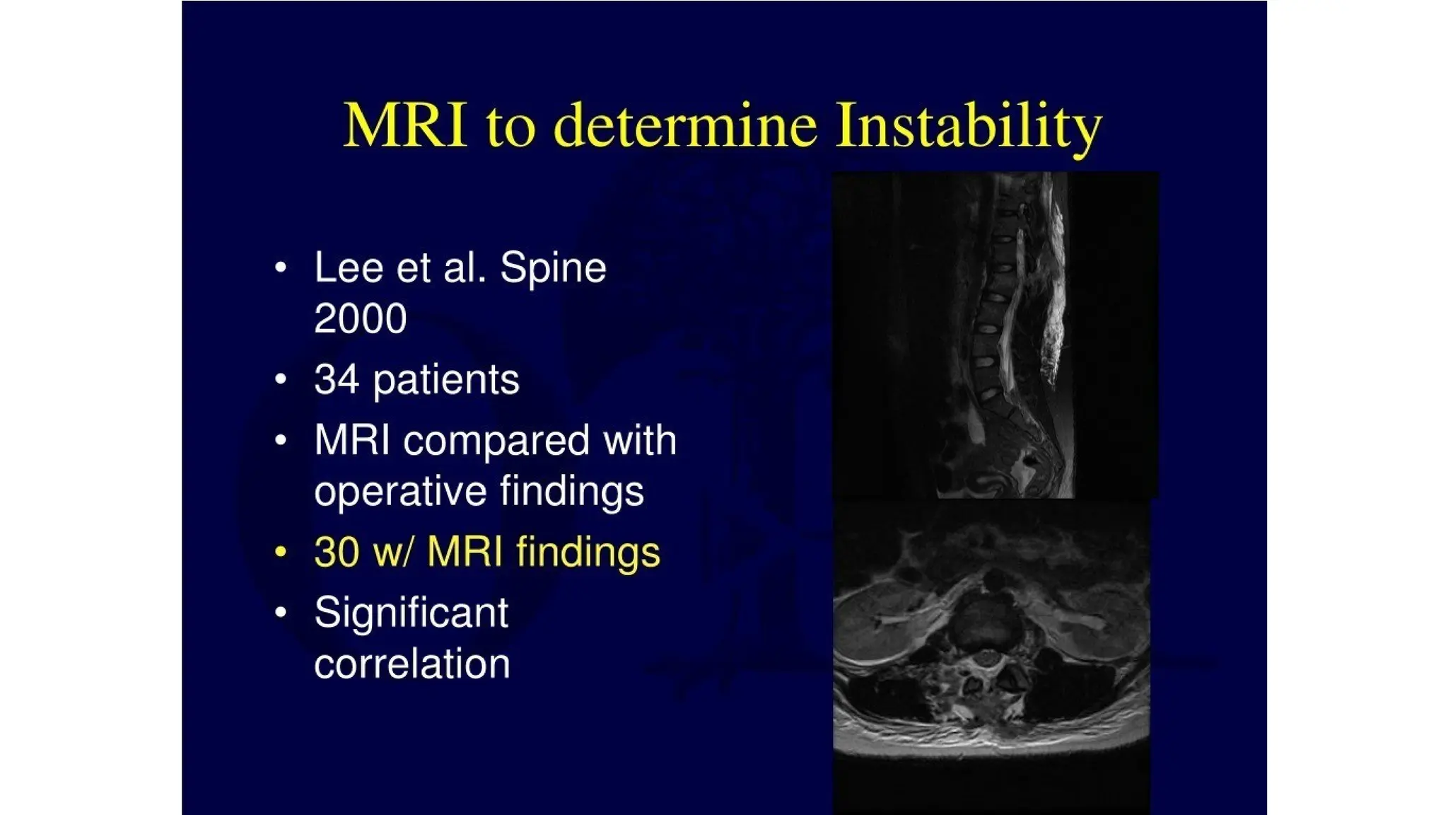 Thoracic And Lumbar Spine Fractures And Dislocations Assessment And Classification Jan 02 2020 Pptx