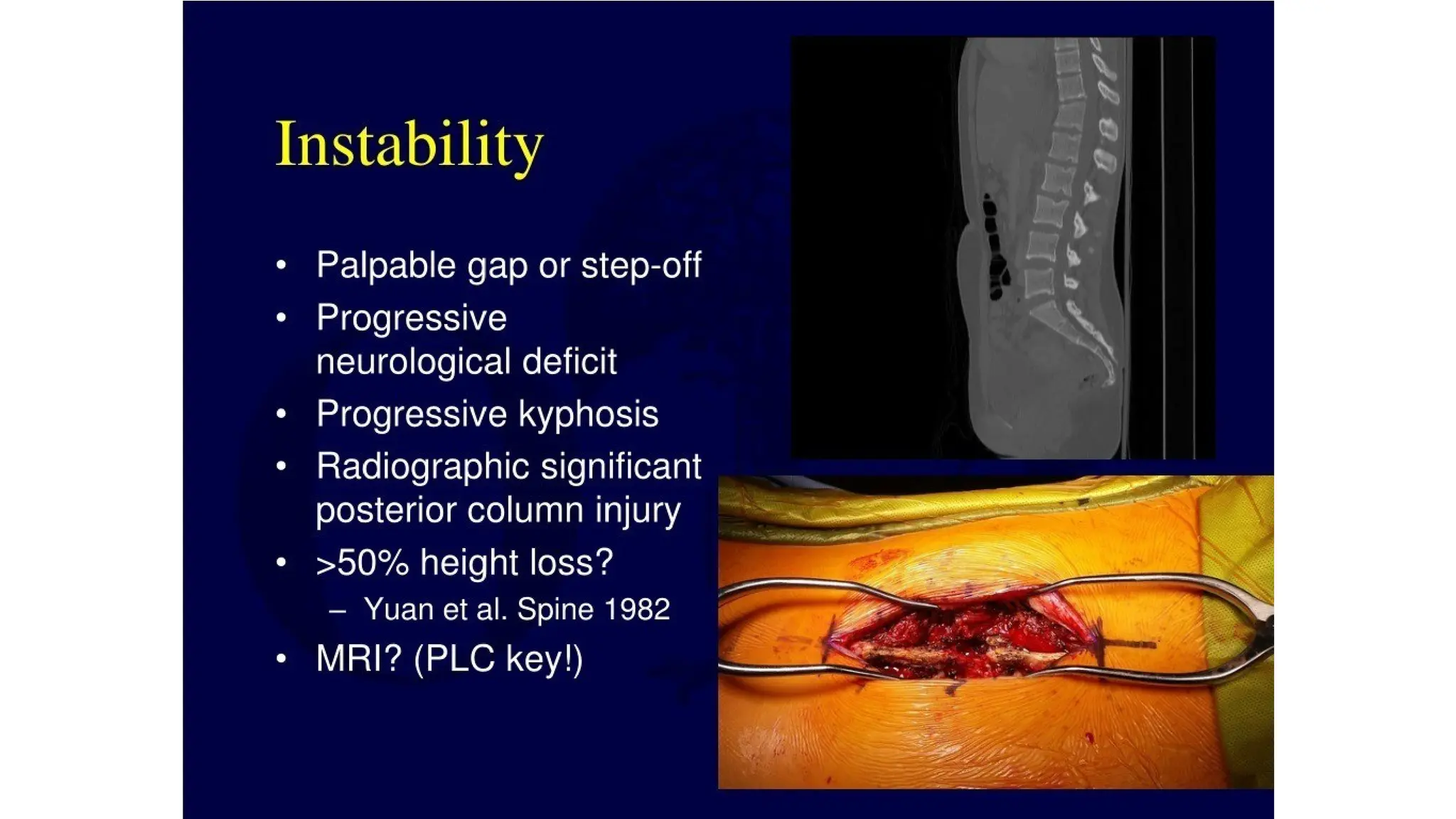 Thoracic and Lumbar Spine Fractures and Dislocations Assessment and ...