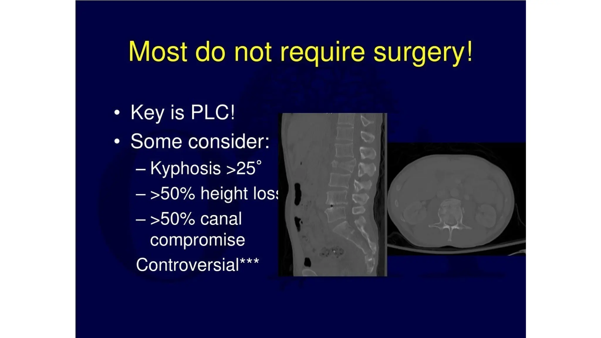 Thoracic And Lumbar Spine Fractures And Dislocations Assessment And Classification Jan 02 2020 Pptx