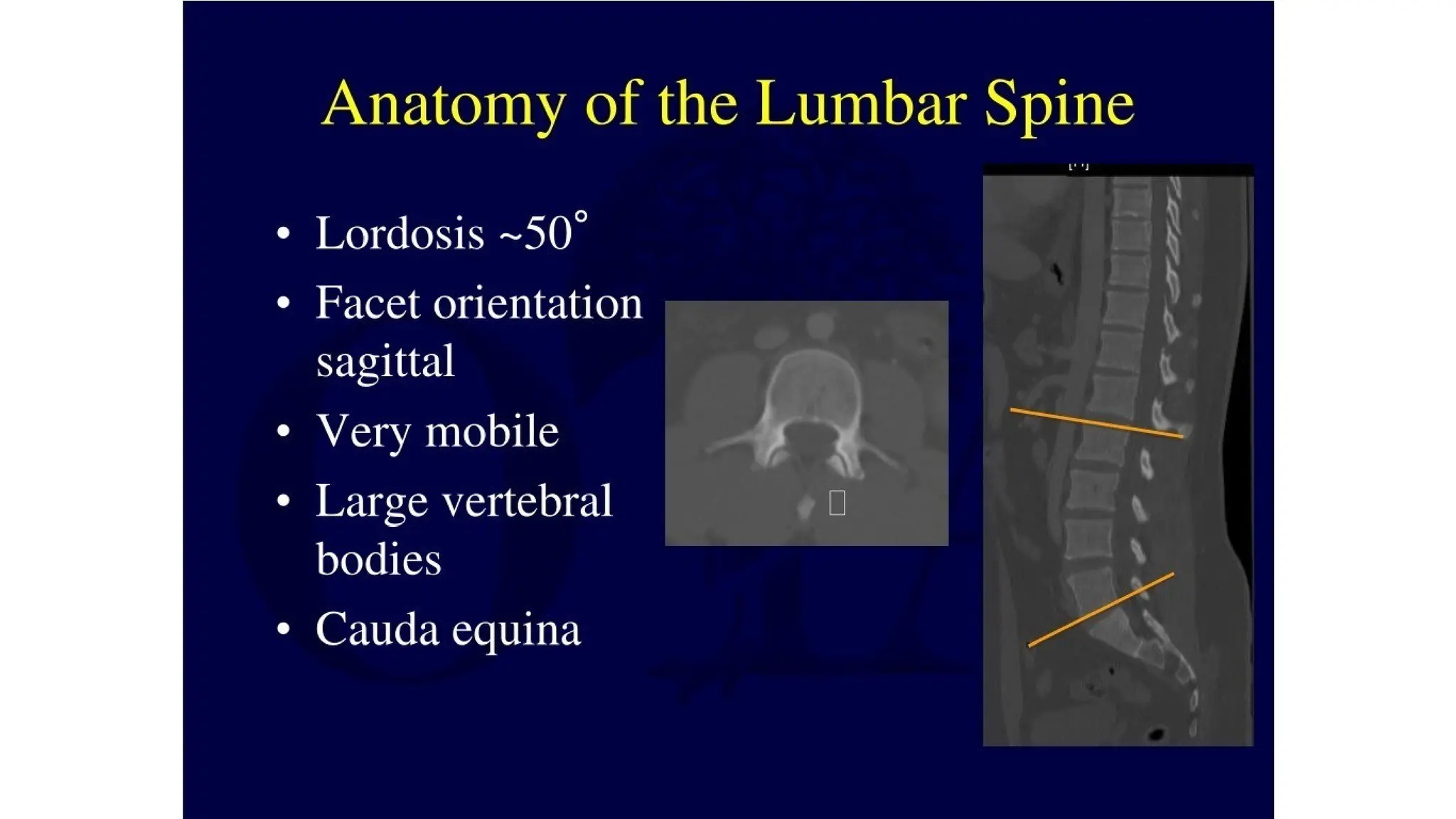 Thoracic and Lumbar Spine Fractures and Dislocations Assessment and ...