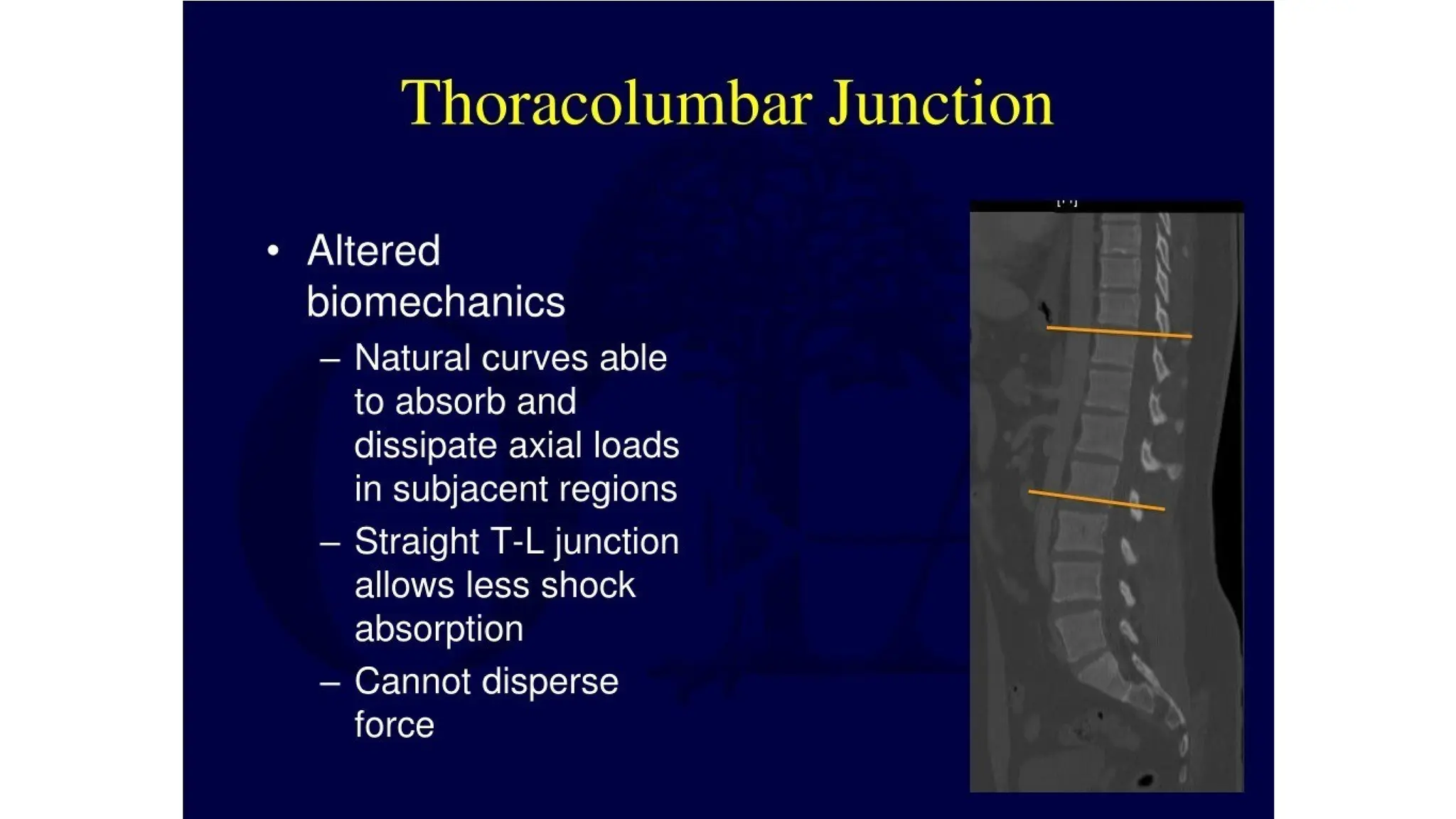 Thoracic and Lumbar Spine Fractures and Dislocations Assessment and ...