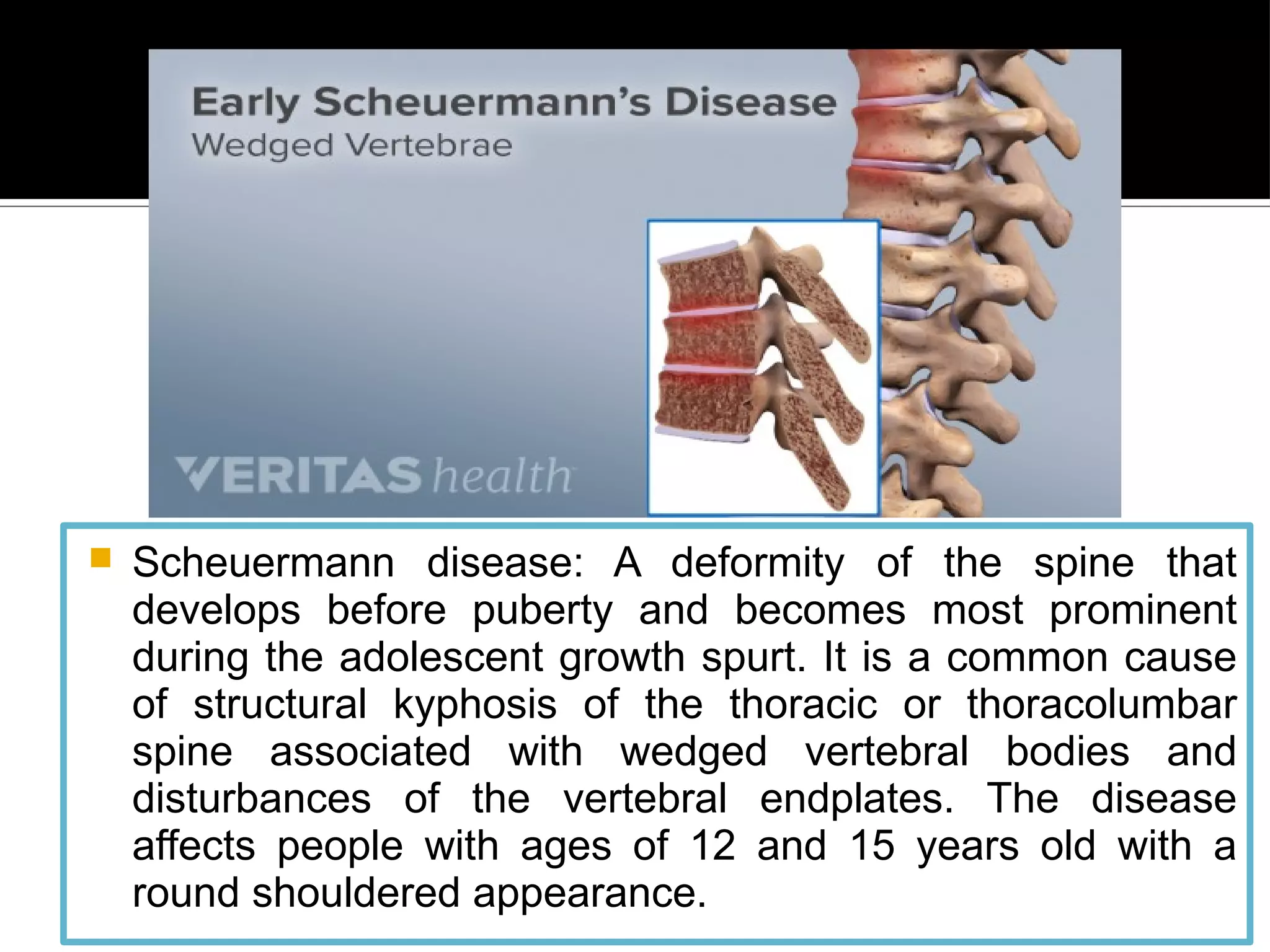 Thoracic and rib cage anatomy, biomechanics, and pathomechanics | PDF