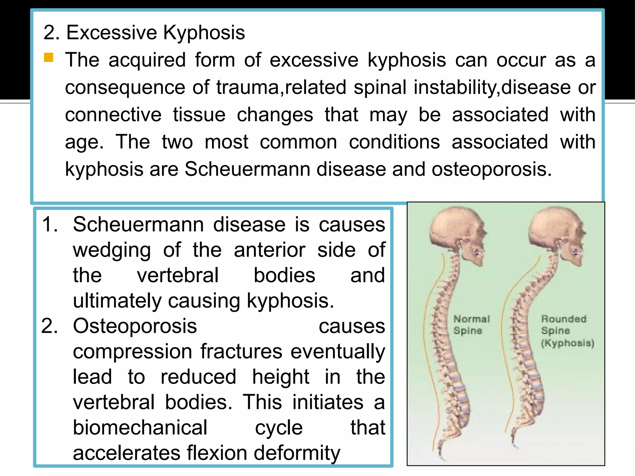 Thoracic and rib cage anatomy, biomechanics, and pathomechanics | PDF