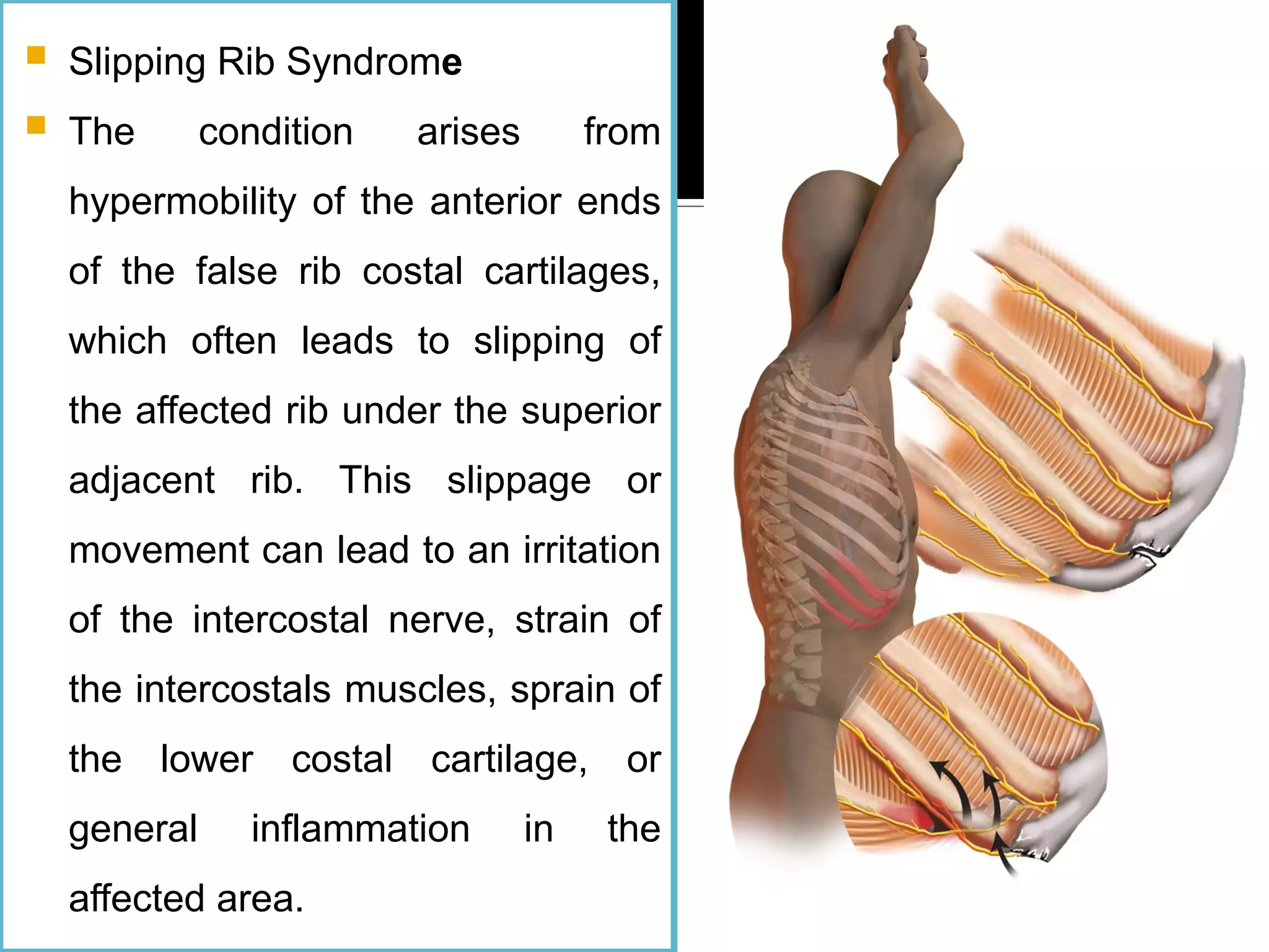 Thoracic and rib cage anatomy, biomechanics, and pathomechanics | PDF