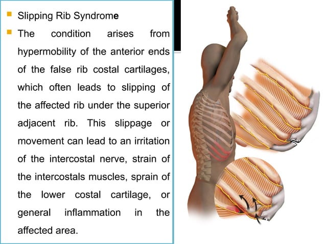 Thoracic and rib cage anatomy, biomechanics, and pathomechanics | PDF