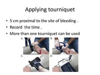 Thoracic and Vascular Injuries in battlefield.pptx
