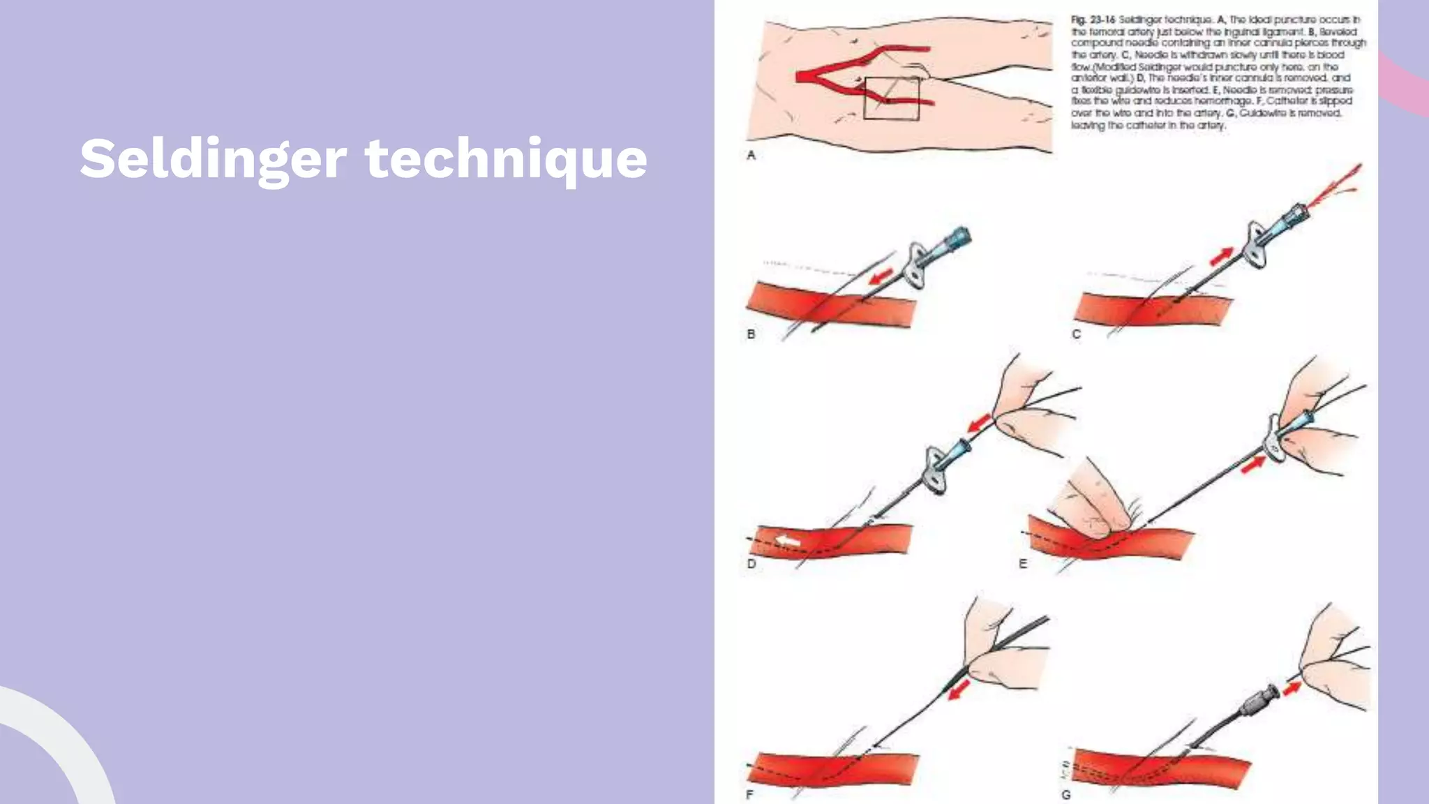 thoracic angiography.pptx