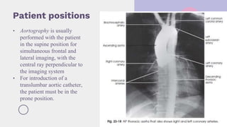 thoracic angiography.pptx