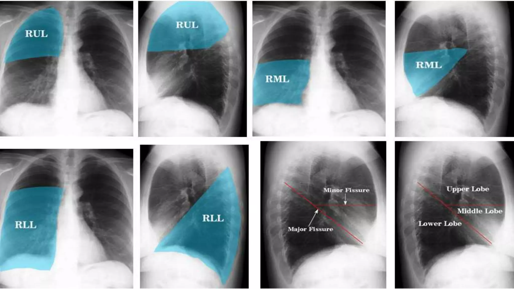 Thoracic anatomy on various imaging modalities | PPT Thoracic anatomy on various imaging modalities | PPT