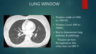 Thoracic anatomy on various imaging modalities | PPTX