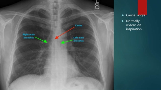 Thoracic anatomy on various imaging modalities