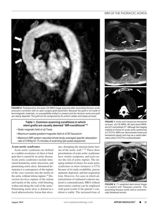 Thoracic aorta mri nice | PDF